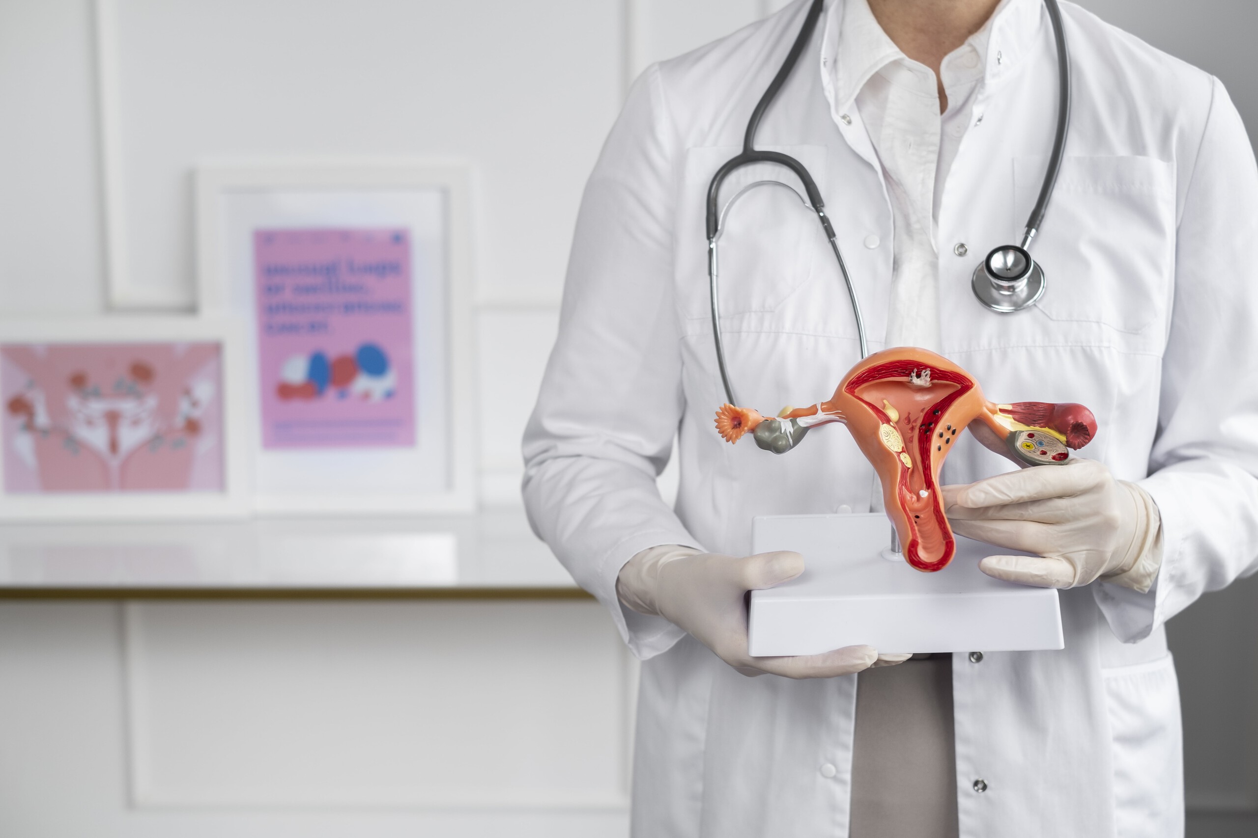 Mioma uterino: Causas, sintomas e tratamento - Mais Saúde